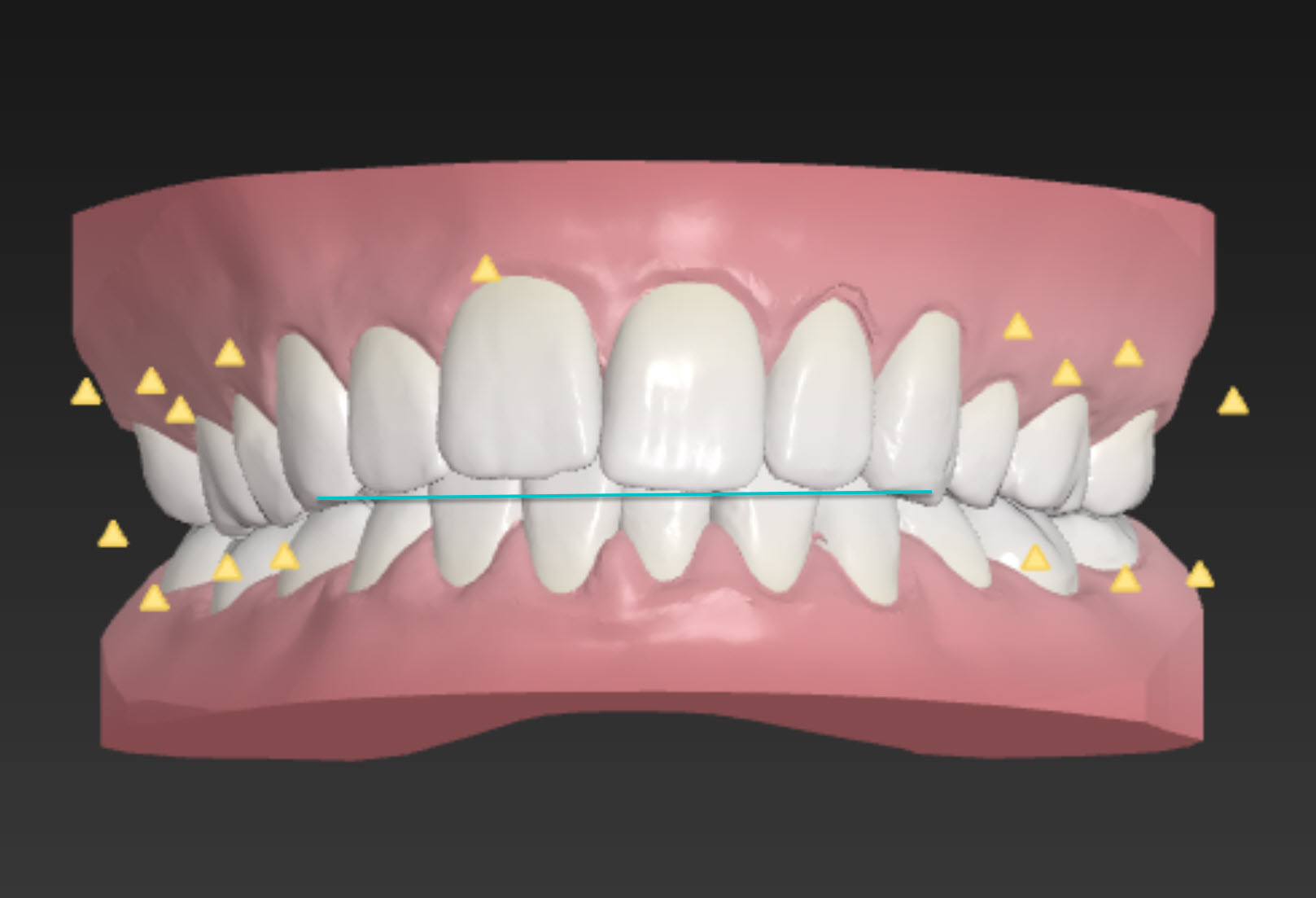 Clinical Photos – ClearCorrect Support