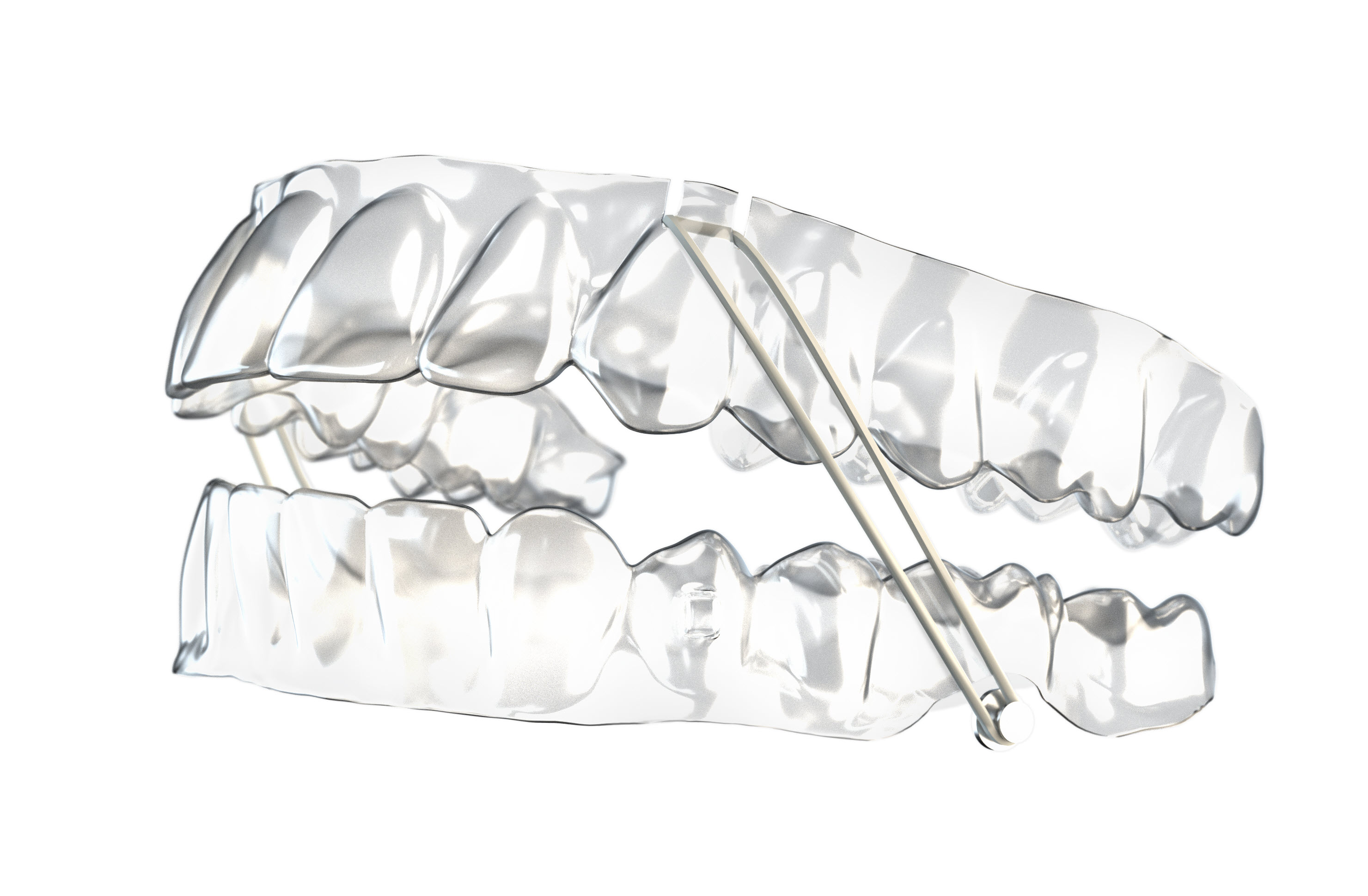 Treatment Preferences – ClearCorrect Support