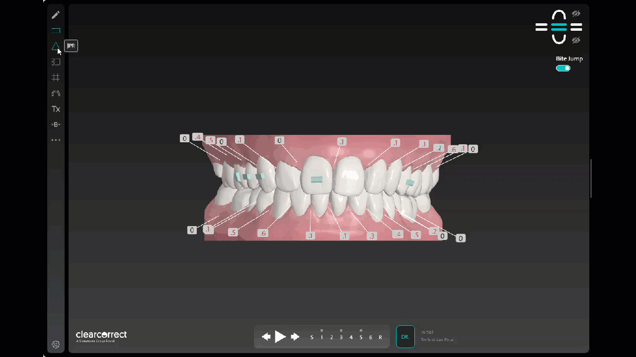 ClearPilot™ - Using the Dr. Edits 3D Controls Tool – ClearCorrect Support