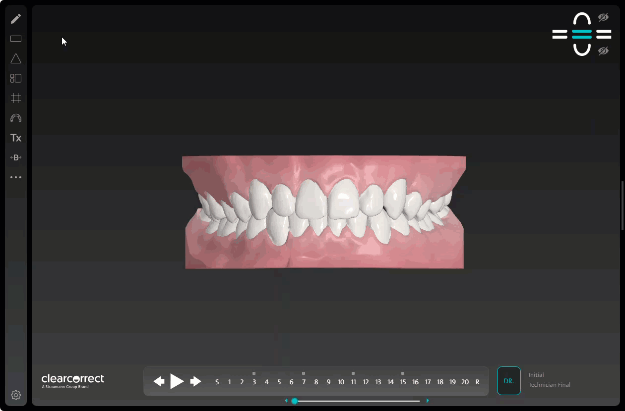 ClearPilot™ - Using the Dr. Edits 3D Controls Tool – ClearCorrect Support