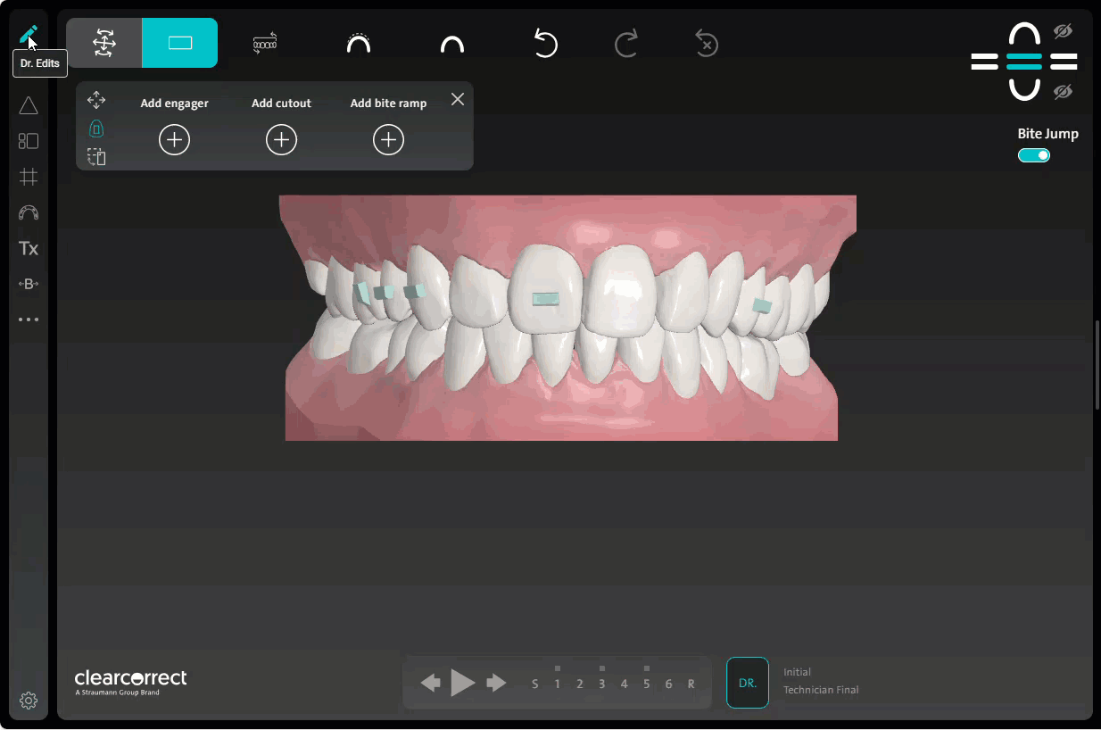ClearPilot™ - Using the Dr. Edits 3D Controls Tool – ClearCorrect Support