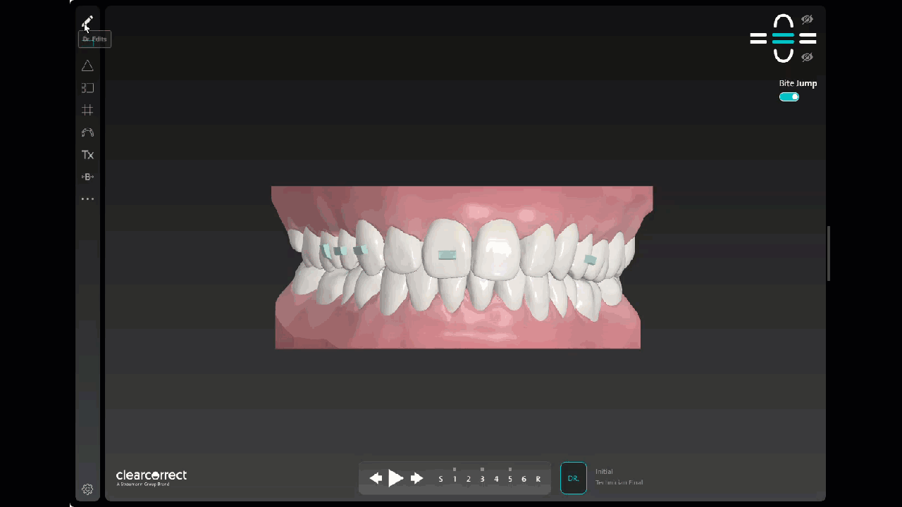 ClearPilot™ - Using the Dr. Edits 3D Controls Tool – ClearCorrect Support