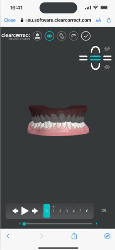 ClearCorrect® Sync App - Overview and How to Use – ClearCorrect Support