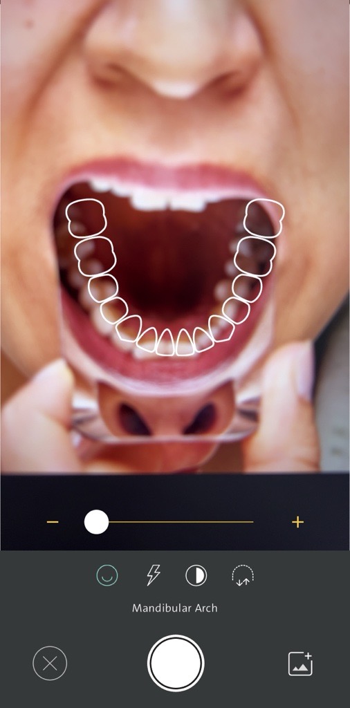 ClearCorrect® Sync App - Overview and How to Use – ClearCorrect Support