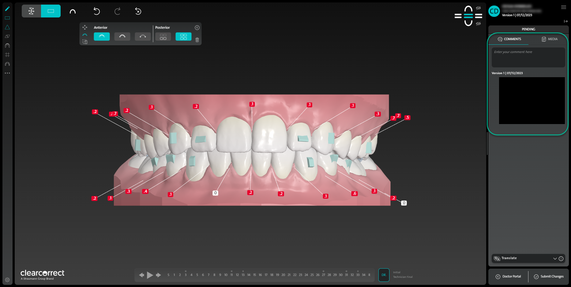 Bite Ramps – ClearCorrect Support