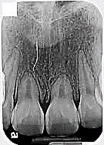 Short Roots - Support