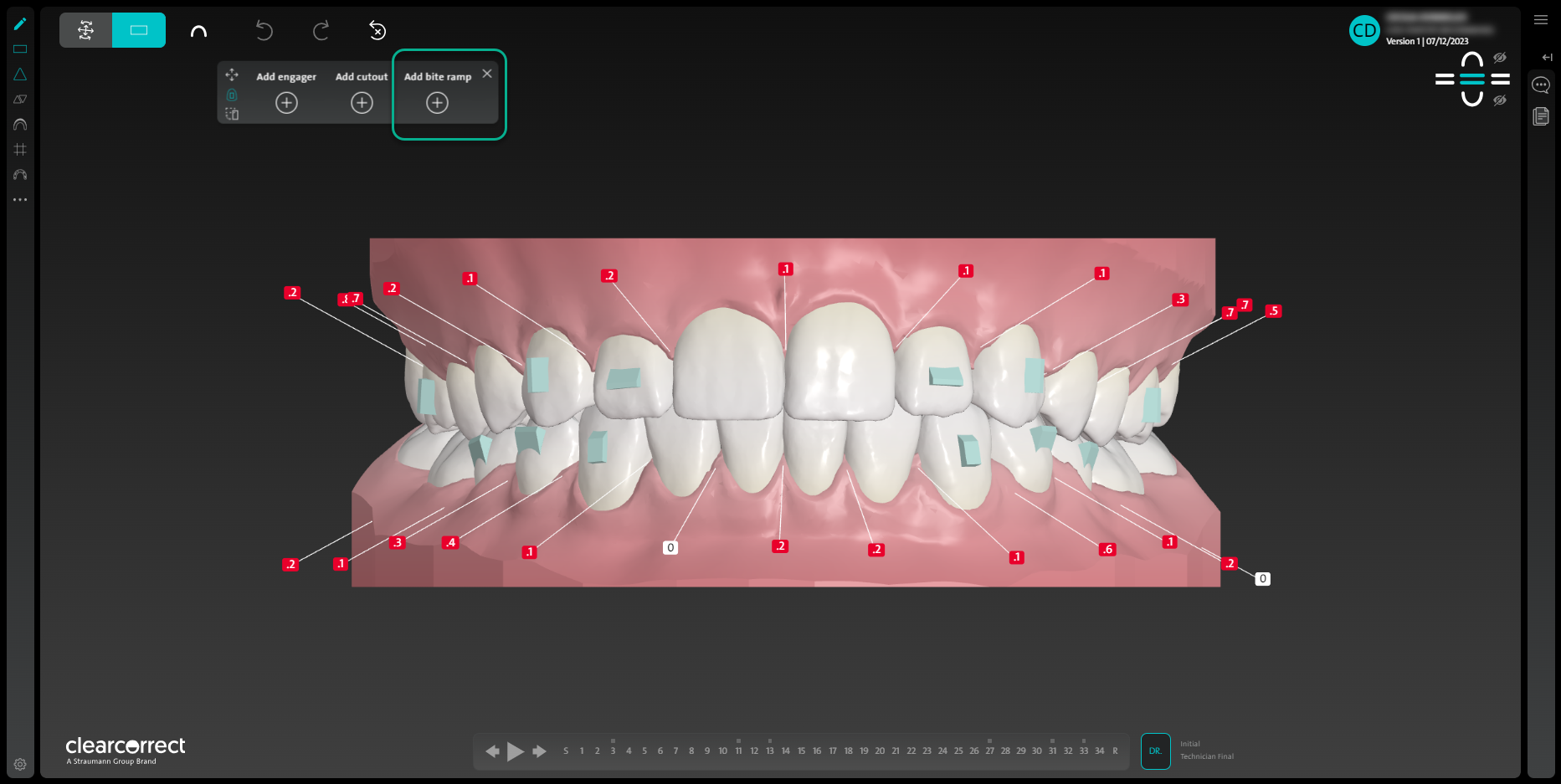 Bite Ramps – ClearCorrect Support