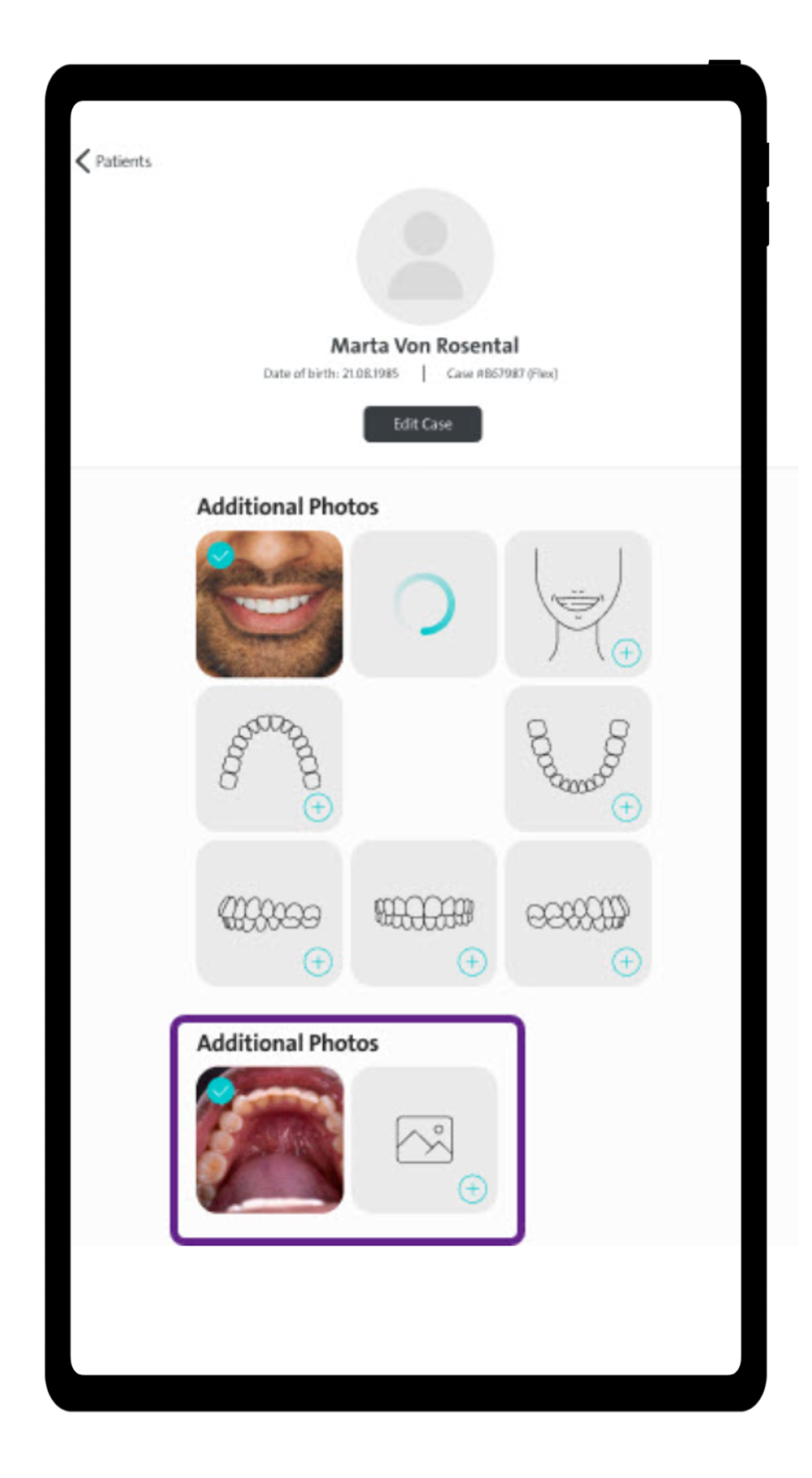 ClearCorrect® Sync App - Overview and How to Use – ClearCorrect Support
