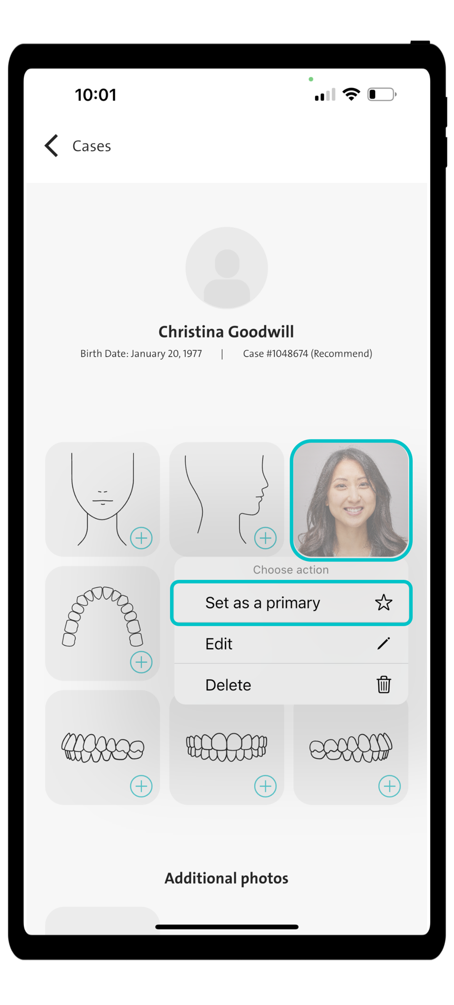 ClearCorrect® Sync App - Overview and How to Use – ClearCorrect Support