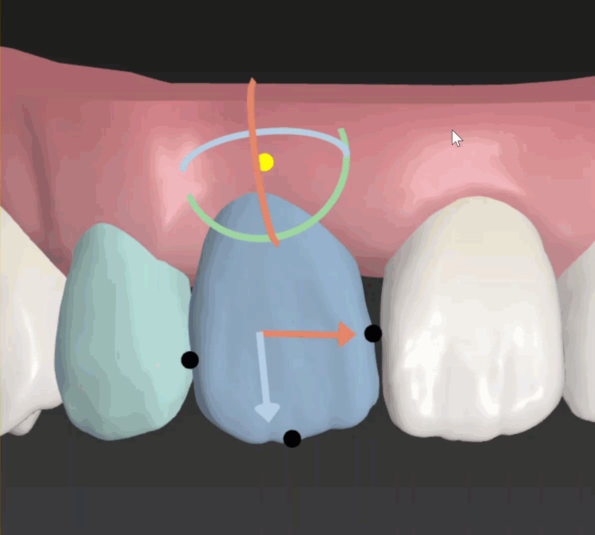 ClearPilot™ - Using the Dr. Edits 3D Controls Tool – ClearCorrect Support