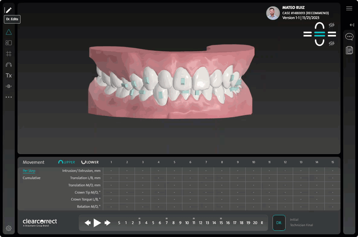 ClearPilot™ - Using the Dr. Edits 3D Controls Tool – ClearCorrect Support