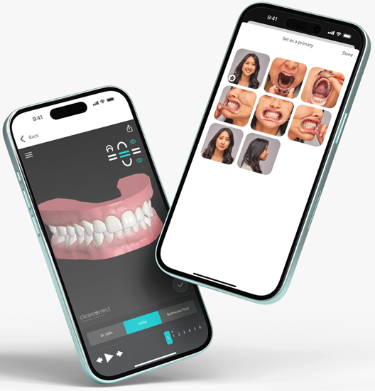 ClearCorrect® Sync App - Overview and How to Use – ClearCorrect Support