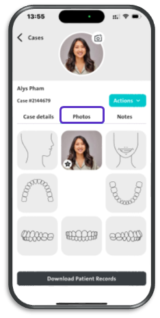 ClearCorrect® Sync App - Overview and How to Use – ClearCorrect Support