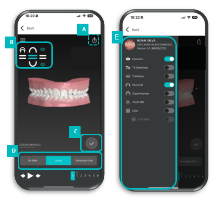 ClearCorrect® Sync App - Overview and How to Use – ClearCorrect Support