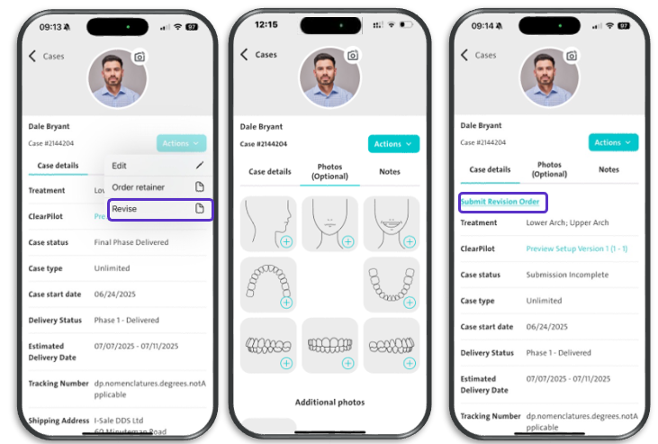 ClearCorrect® Sync App - Overview and How to Use – ClearCorrect Support