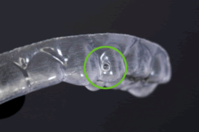 Dimples - Where to place – ClearCorrect Support